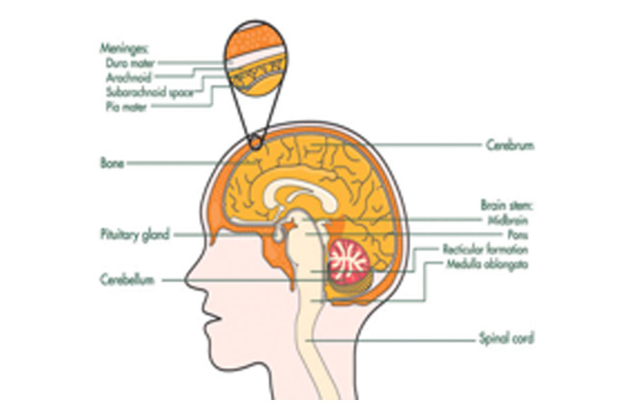 medulloblastoma