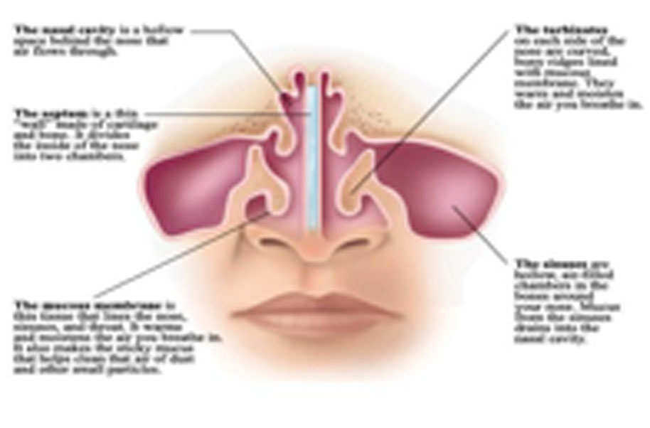 Chronic Rhinitis