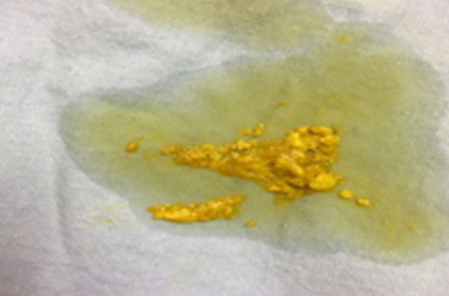 Yellow Poop