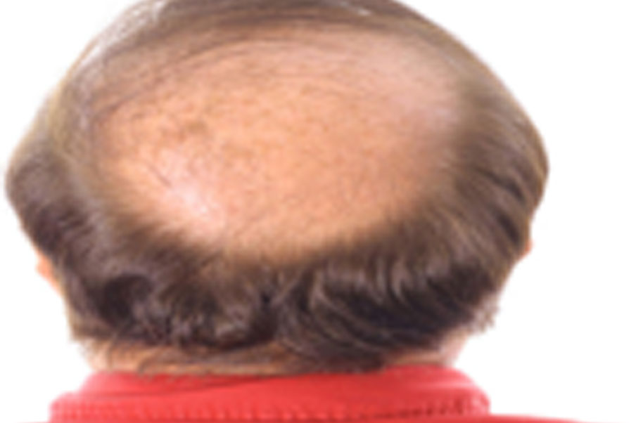 Slow Hair Growth Slow Hair Growth