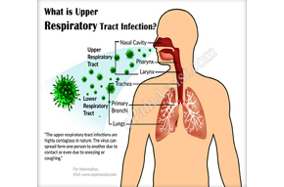 Upper Respiratory Infection Upper Respiratory Infection